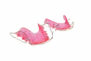 Different Types of Retainers After Braces - What You Need to Know