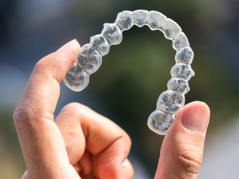 Essix Retainer: What It Is, Benefits & How It Works